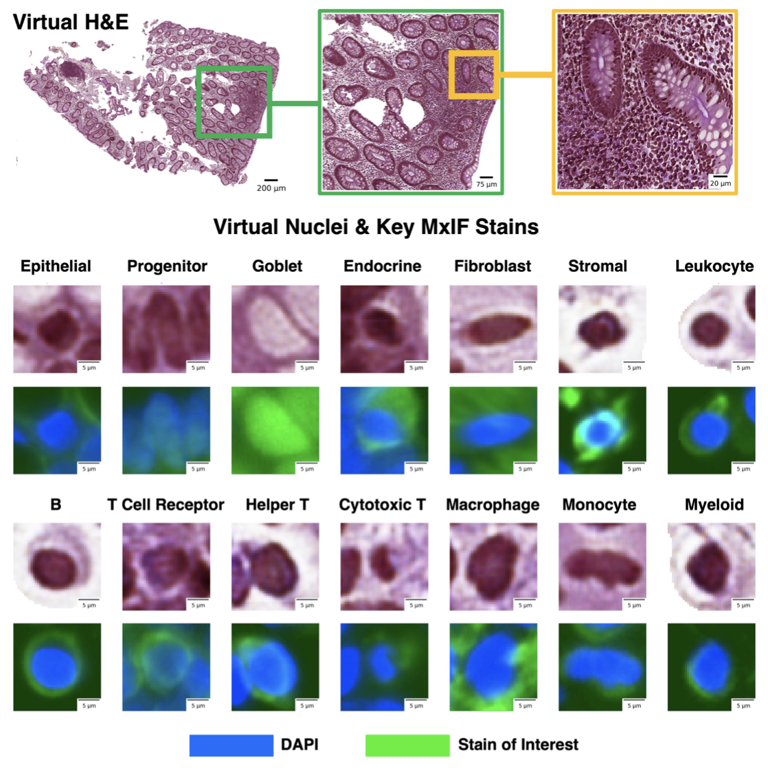 Nucleus subtype classification using inter-modality learning | VALIANT | Vanderbilt University